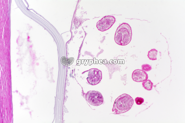 Taenia - ver parasite - Kyste hydatique x40 - Photo BN 53026 - Gryphea